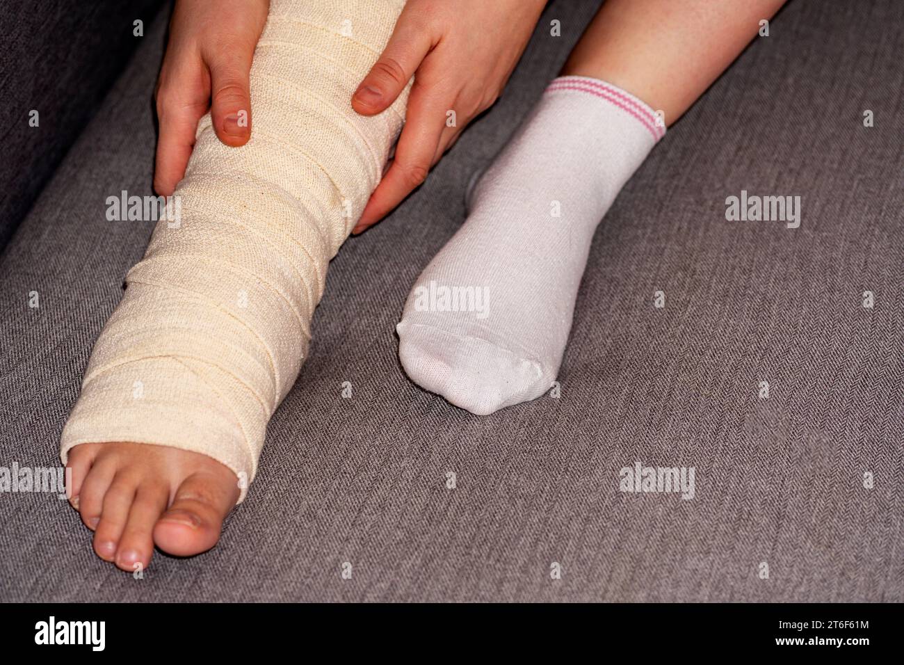 Woman with broken leg. female bandaging foot on the floor. The concept ...