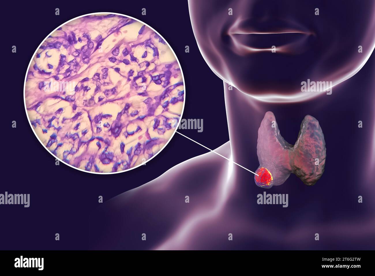 A 3D scientific illustration showcasing a human body with transparent ...