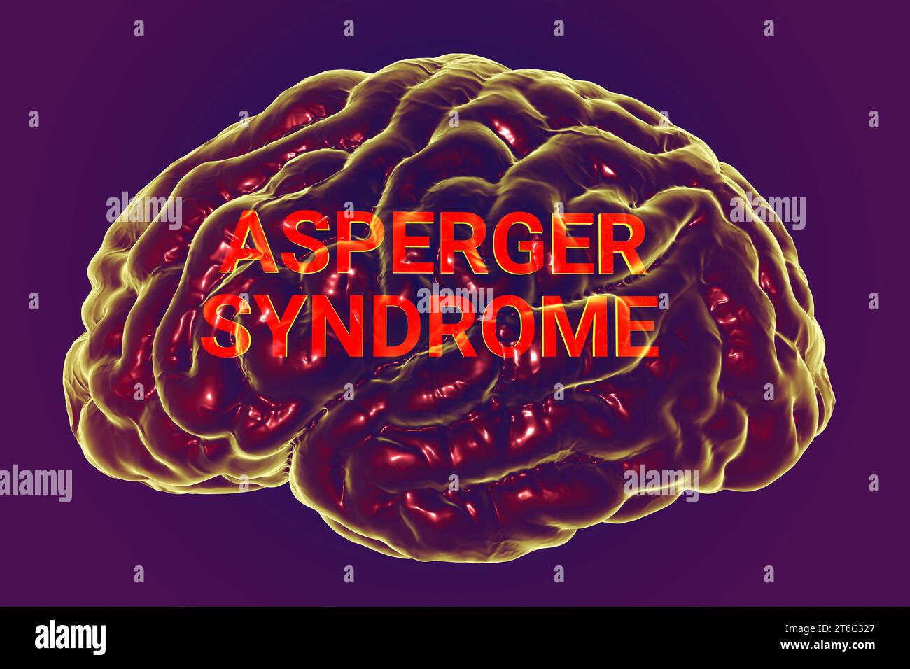 A conceptual 3D illustration featuring the text Asperger Syndrome ...