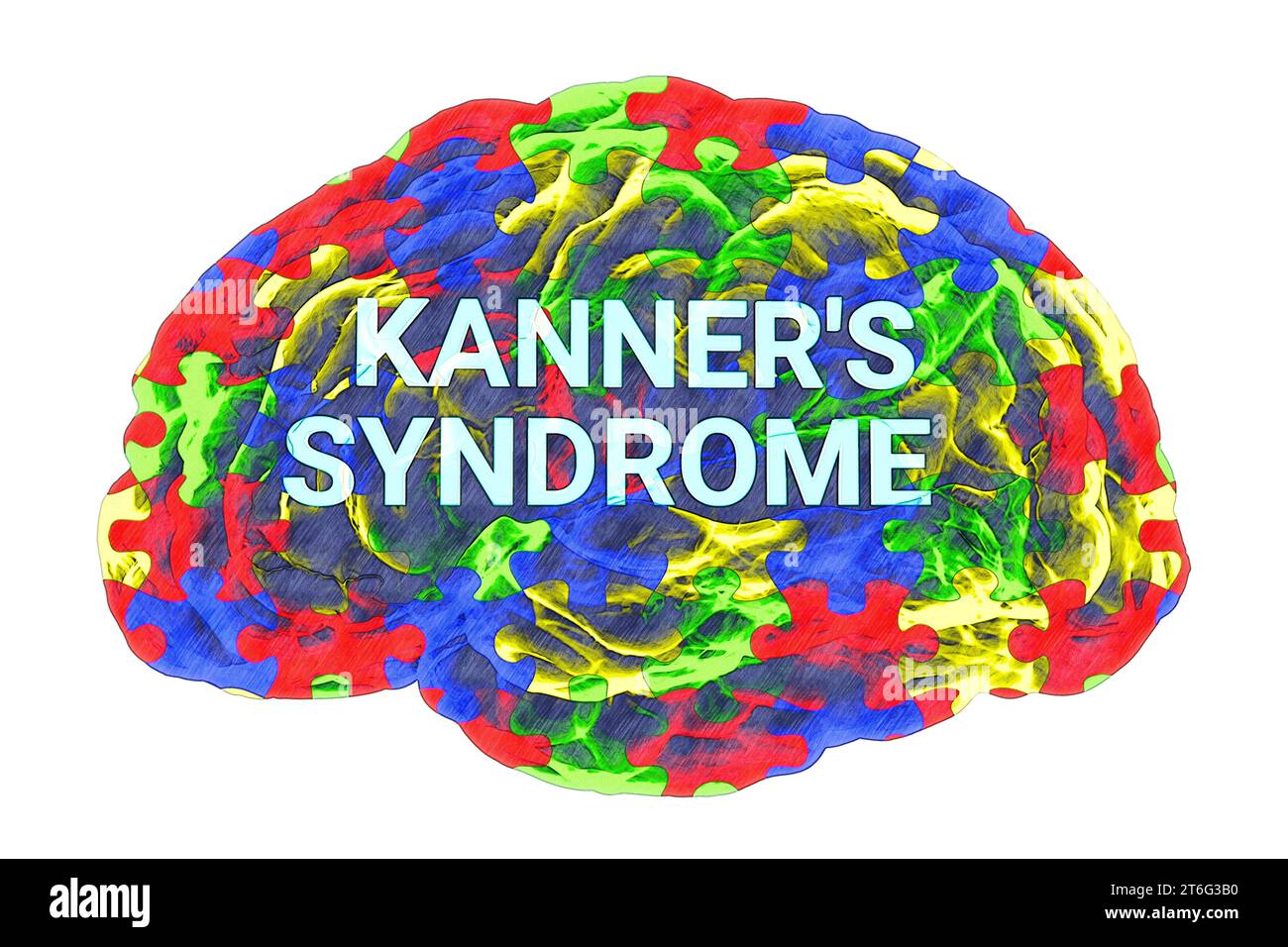 Text Kanner's syndrome inside the model of a human brain, with a ...