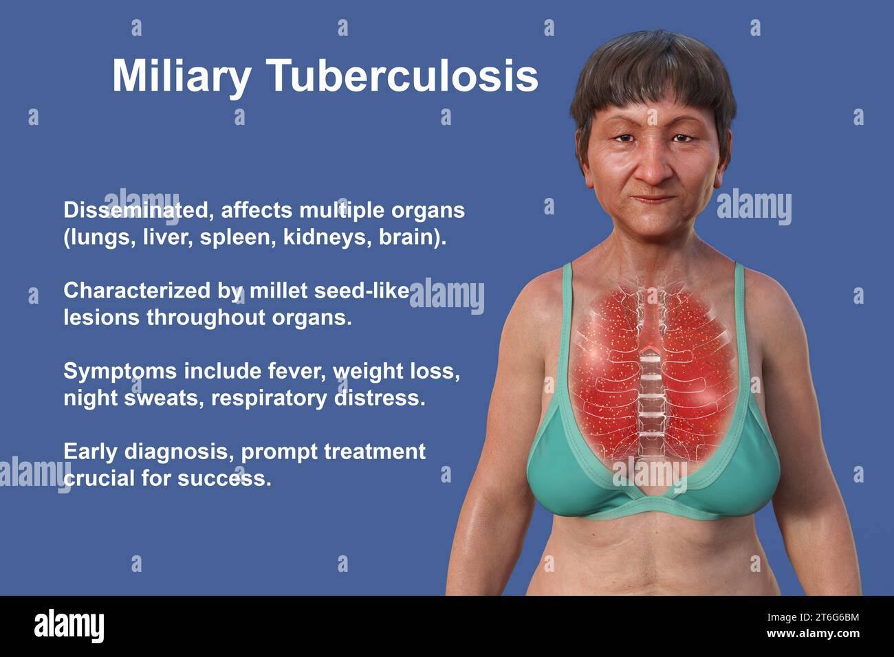 A 3D photorealistic illustration of the upper half of a woman with transparent skin, showcasing ...