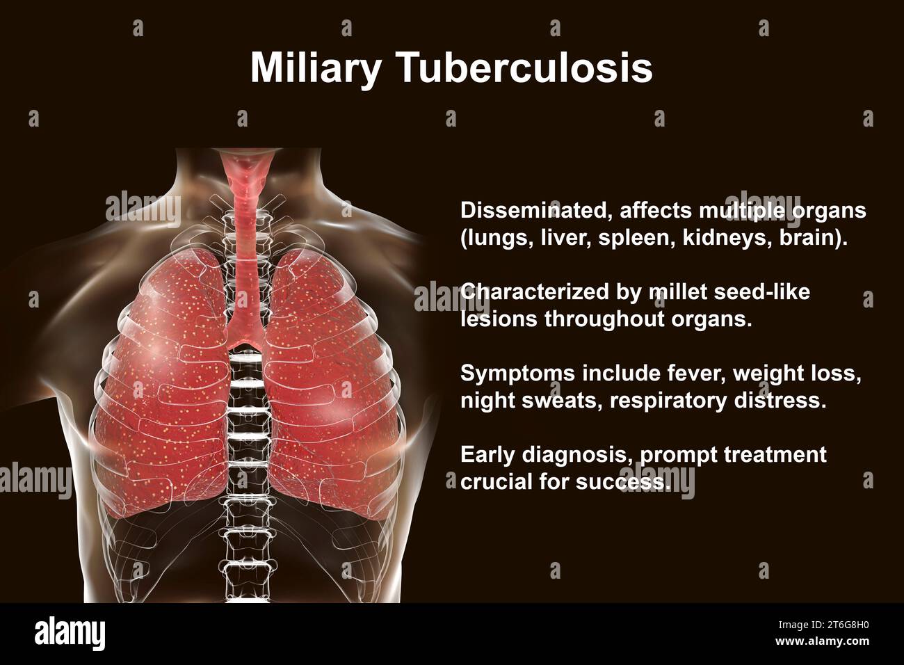 A detailed 3D photorealistic illustration showcasing human lungs ...