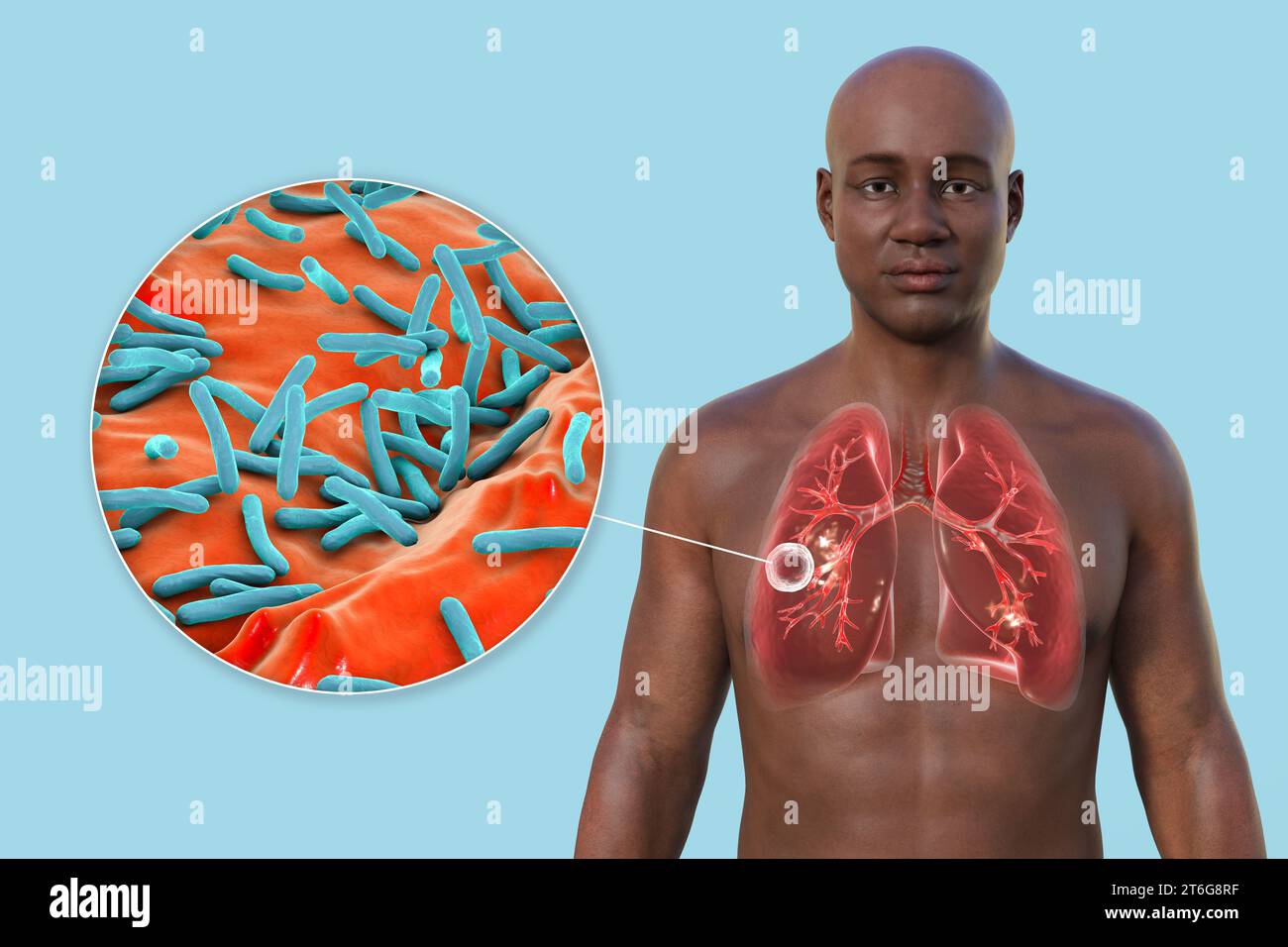 A 3D photorealistic illustration of the upper half of a man with ...