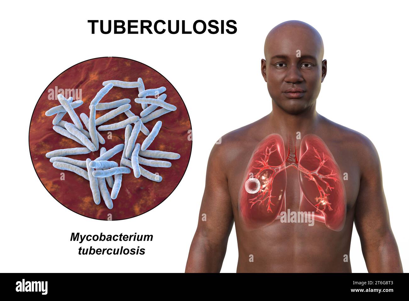 A 3D photorealistic illustration of the upper half of a man with ...