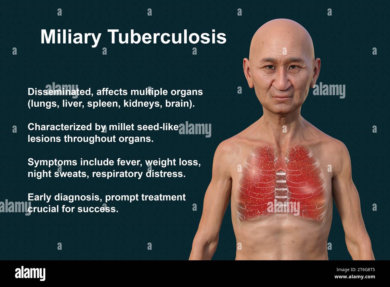 A 3D photorealistic illustration of the upper half of a man with ...