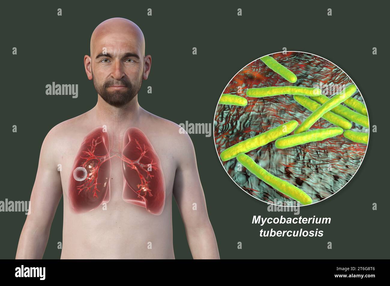 A 3D photorealistic illustration of the upper half of a man with ...