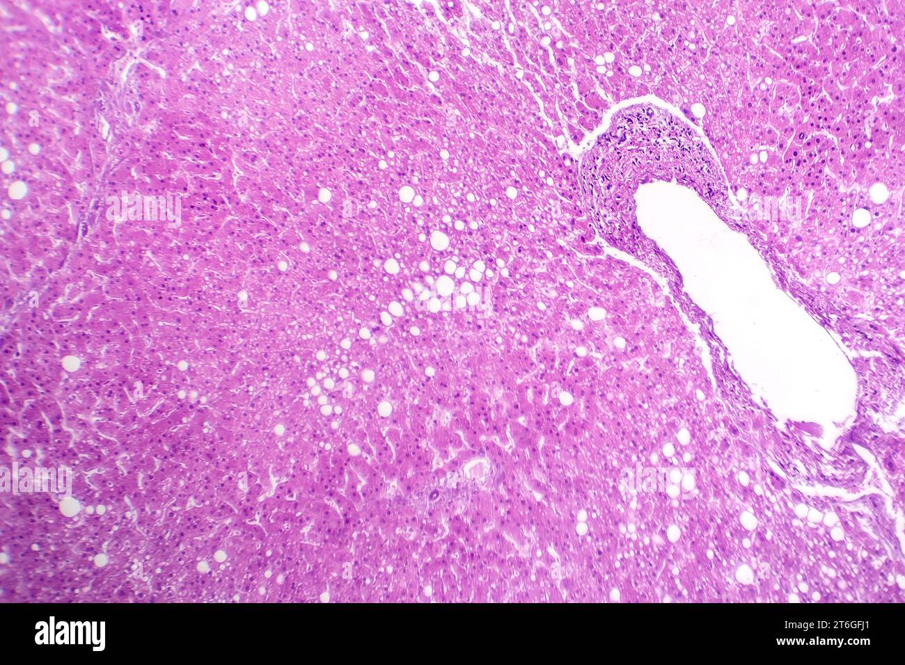 Fat cells function hi-res stock photography and images - Alamy