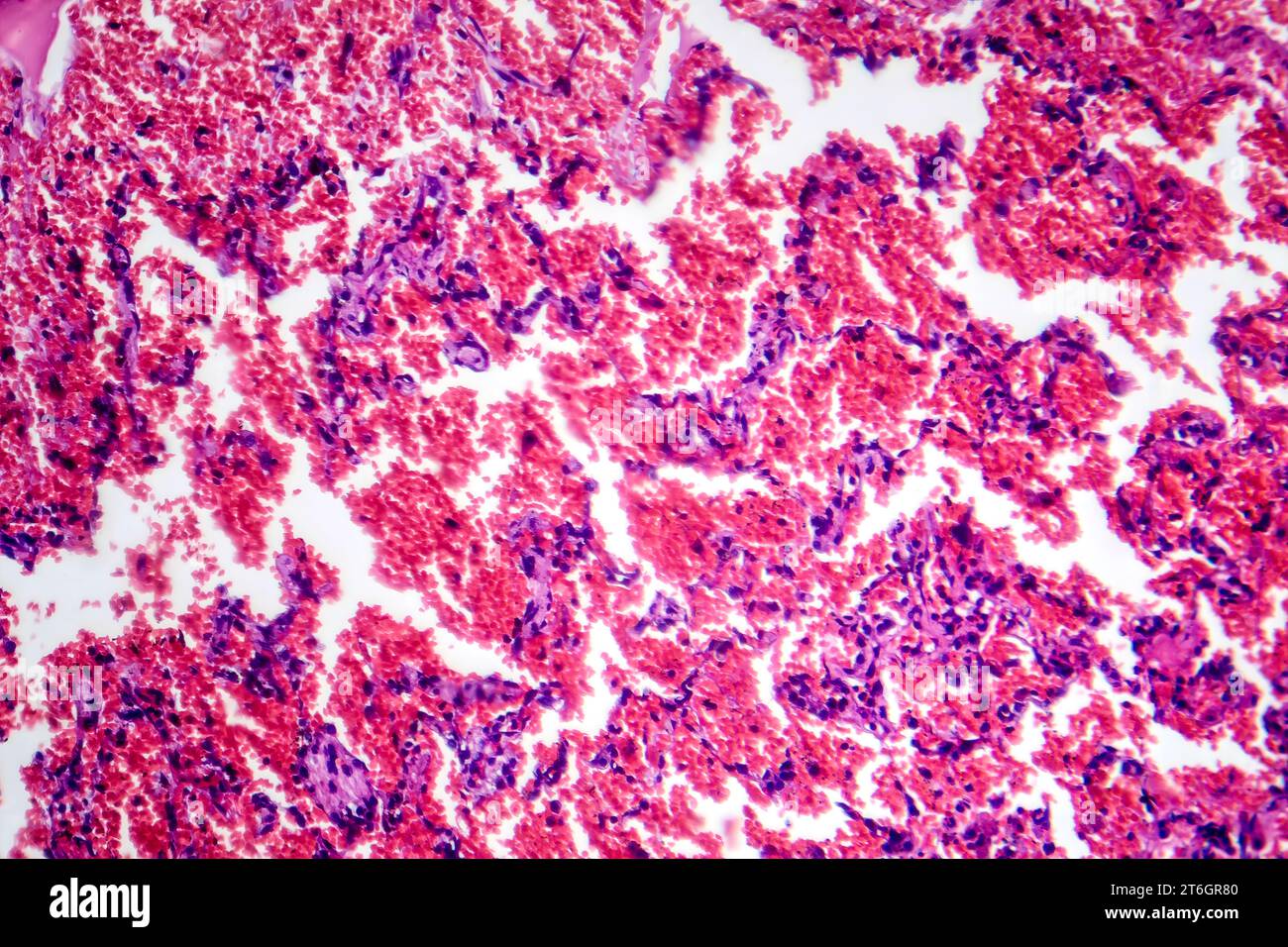 Alveoli micrograph hi-res stock photography and images - Alamy