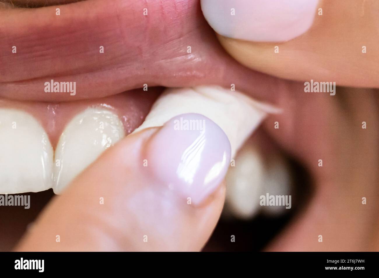 Woman Chewing Tobacco: Snus Pouch and Nicotine Chewables Stock Photo ...