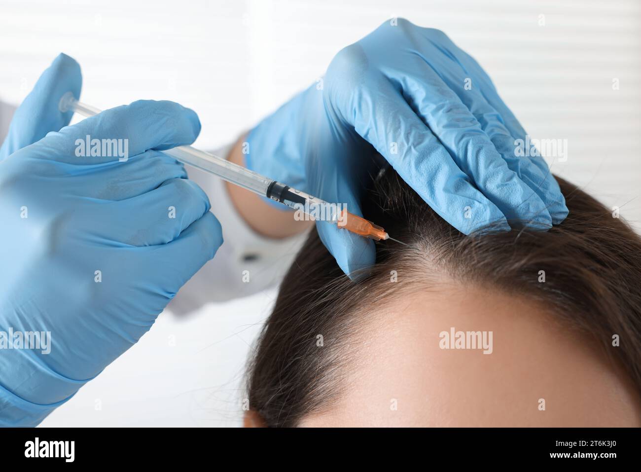 Doctor trichologist hi-res stock photography and images - Alamy