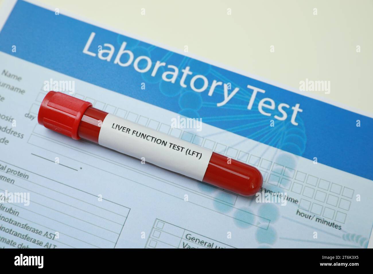 Liver Function Test. Tube with blood sample and form on white table ...