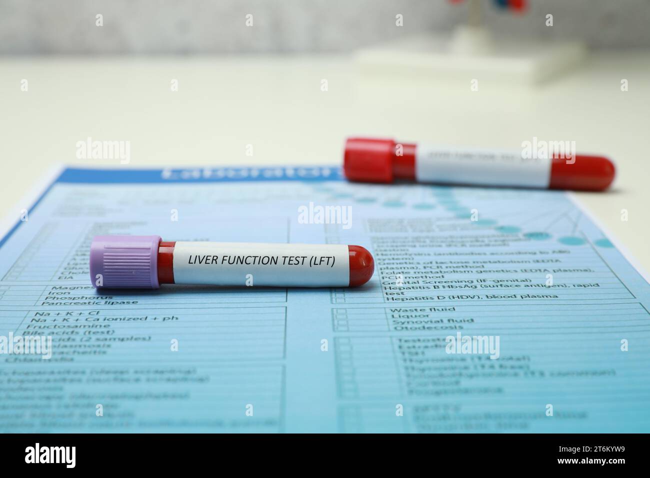 Test tubes blood on table hi-res stock photography and images - Alamy