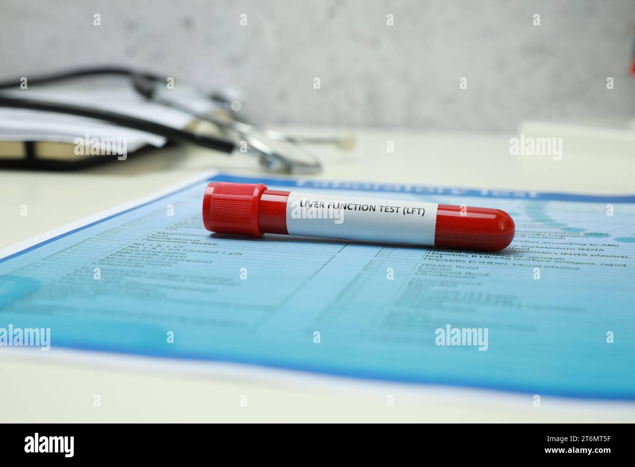 Liver Function Test. Tube with blood sample and form on white table ...