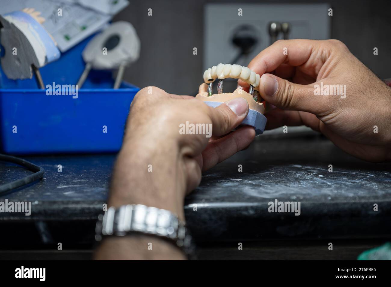 Dental gypsum models in dental laboratory with single tooth crown to be ...