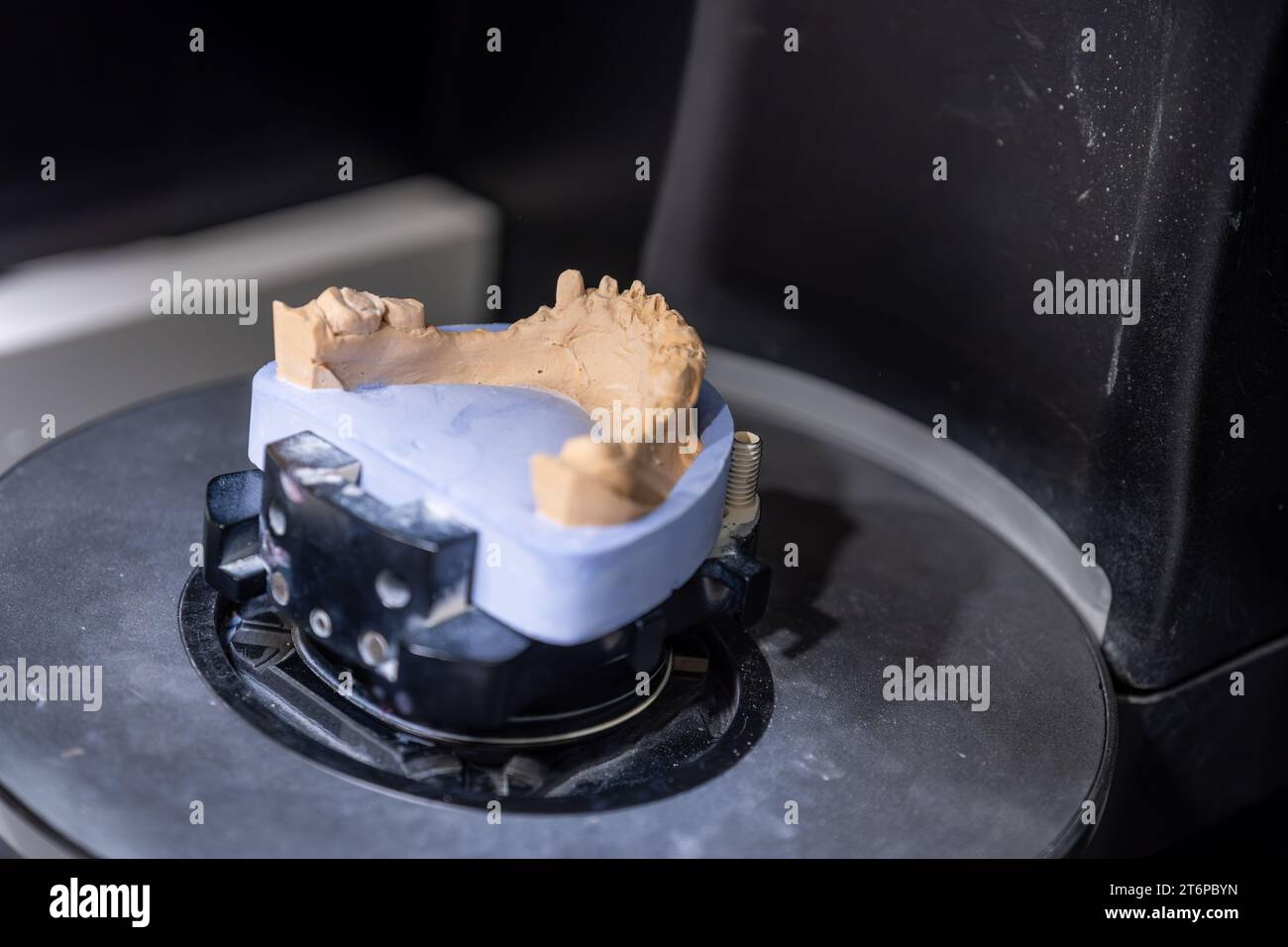 Dental 3D scanner. Dental scan with prosthesis. Create three ...