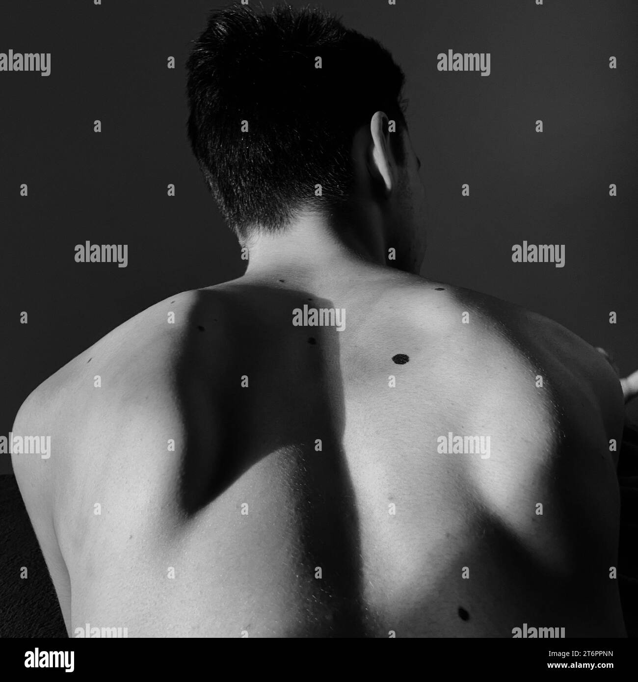 A grayscale rear view of a man's back with moles Stock Photo - Alamy