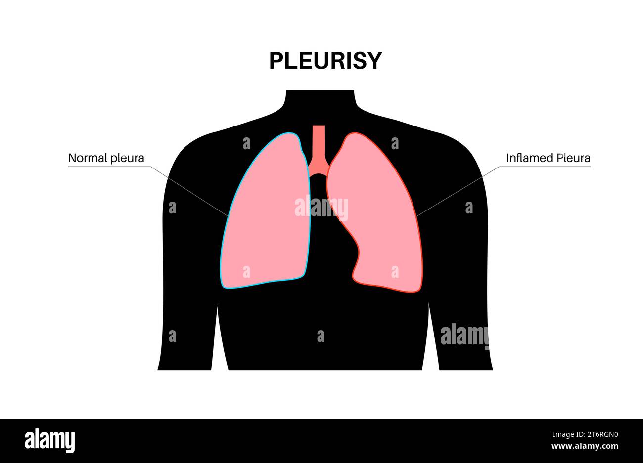 Bone anatomy labeled diagram Cut Out Stock Images & Pictures - Alamy