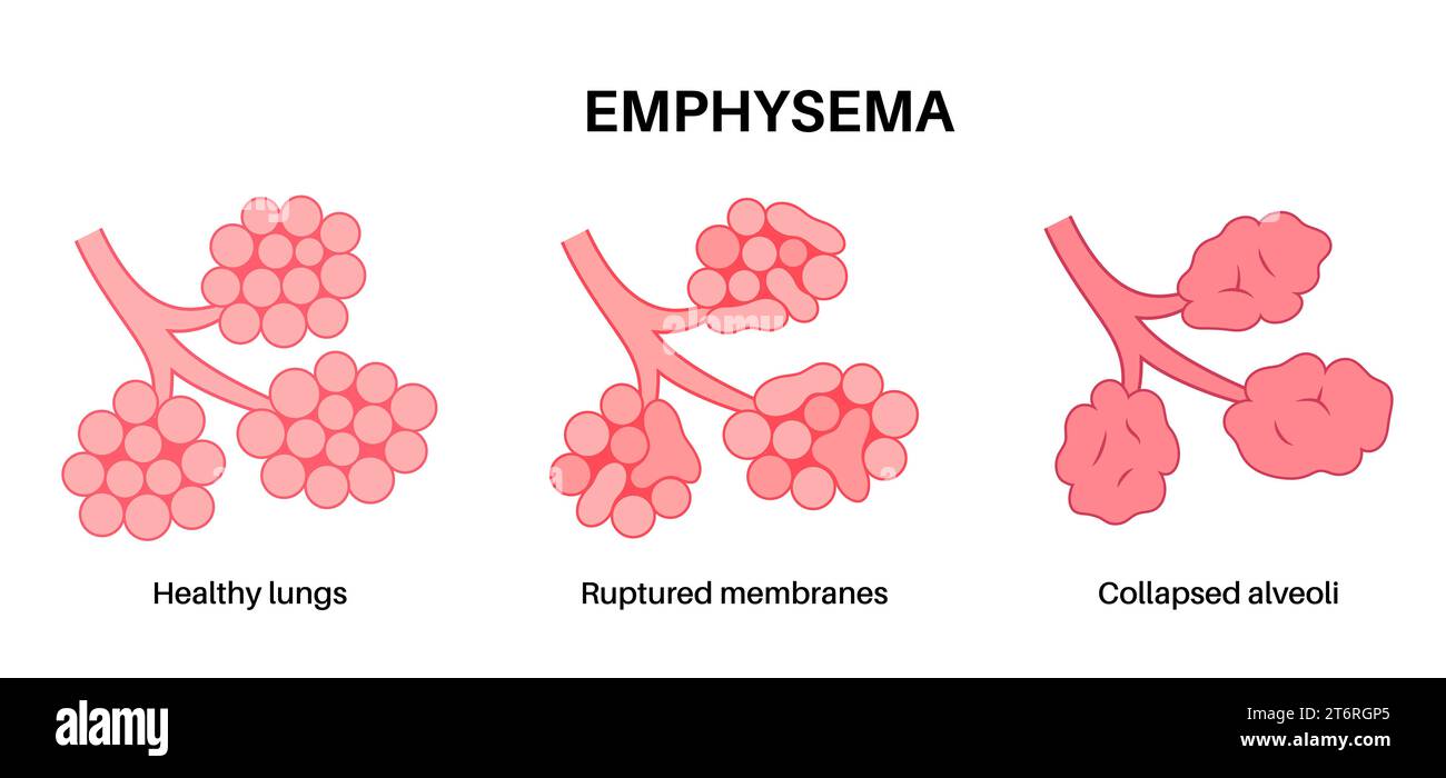 Cell labelled diagram hi-res stock photography and images - Alamy