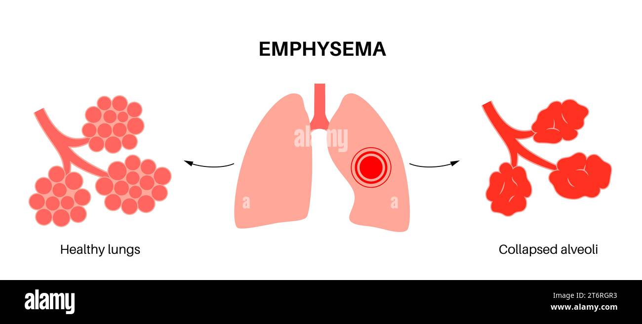 Cell labelled diagram hi-res stock photography and images - Alamy