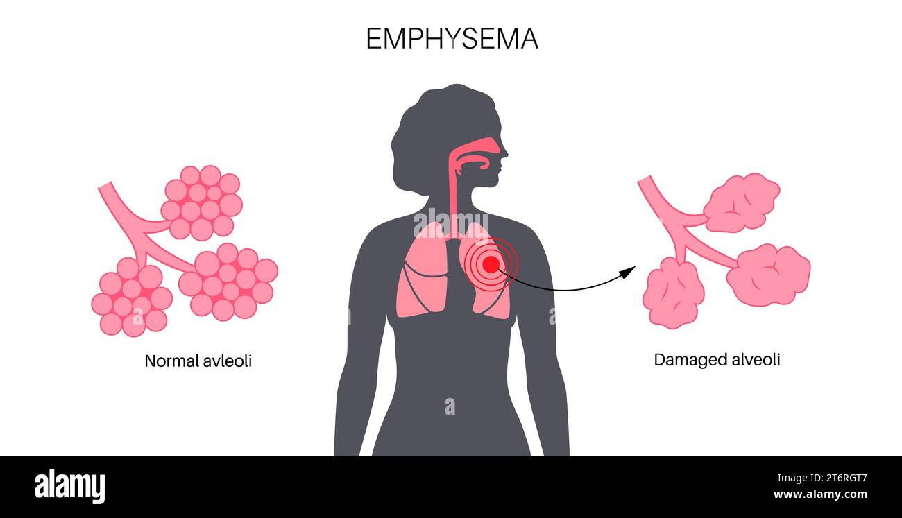 Cell labelled diagram hi-res stock photography and images - Alamy