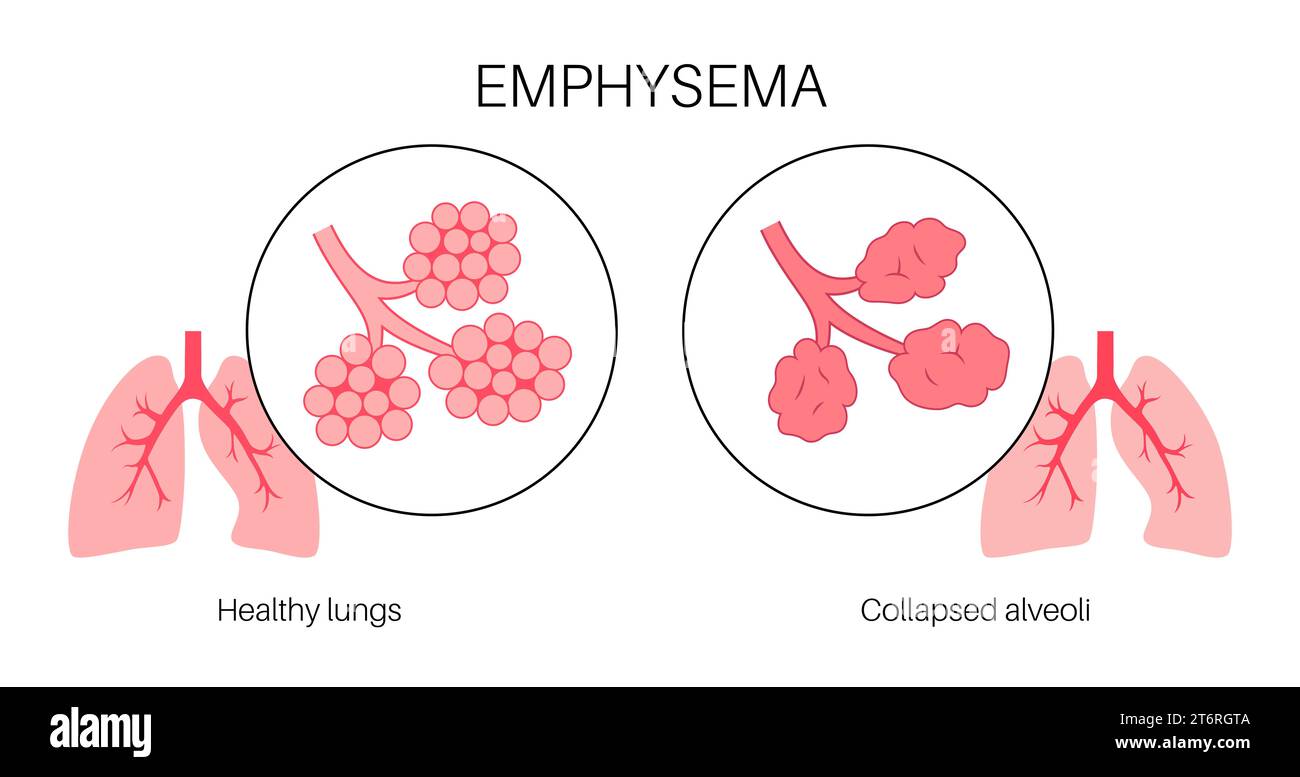 Cell labelled diagram hi-res stock photography and images - Alamy
