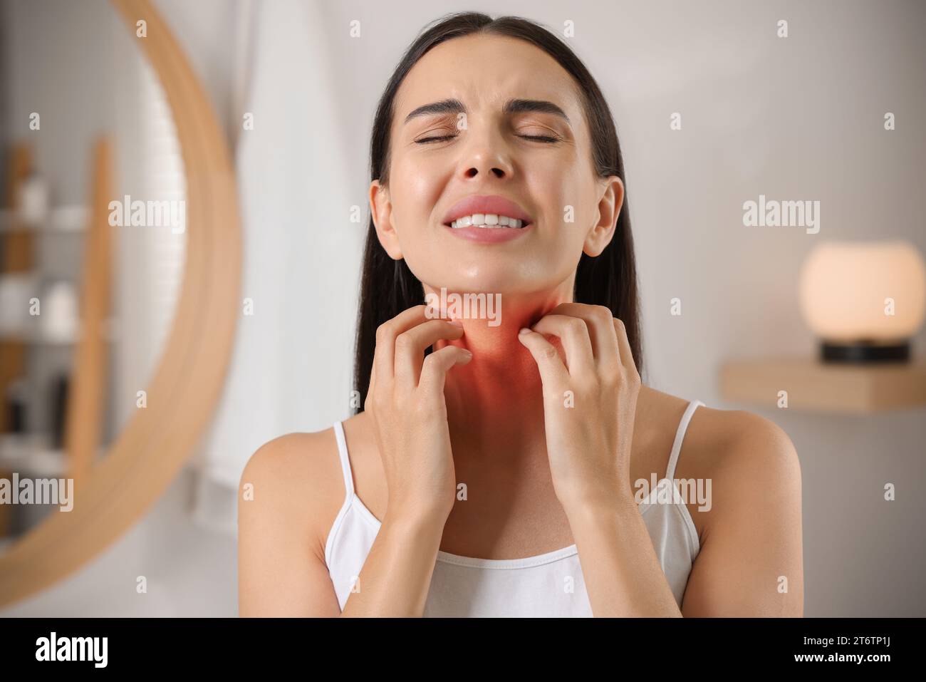 Suffering from allergy. Young woman scratching her neck indoors Stock ...