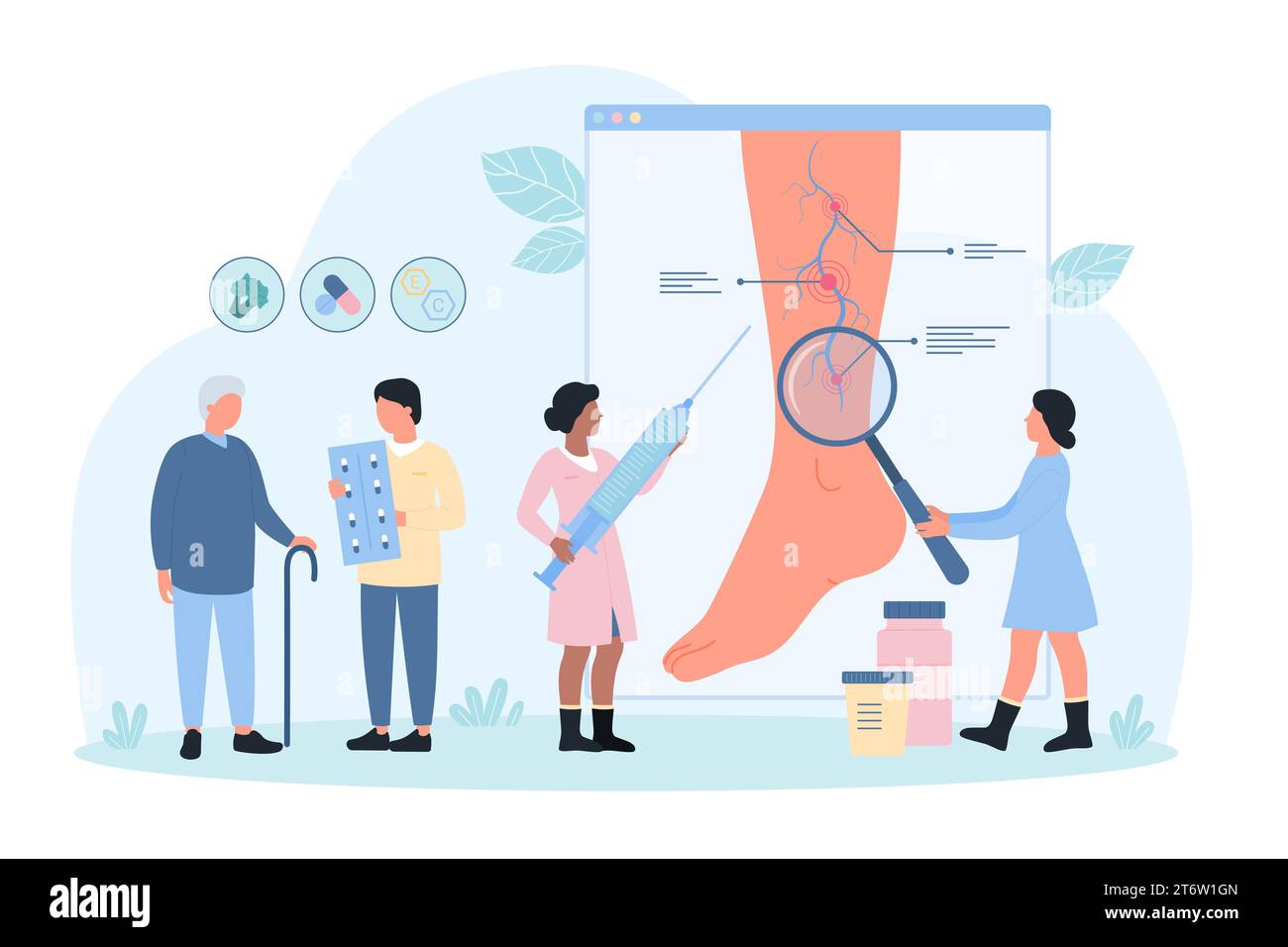Varicose, vein thrombosis diagnosis and treatment on phlebology ...