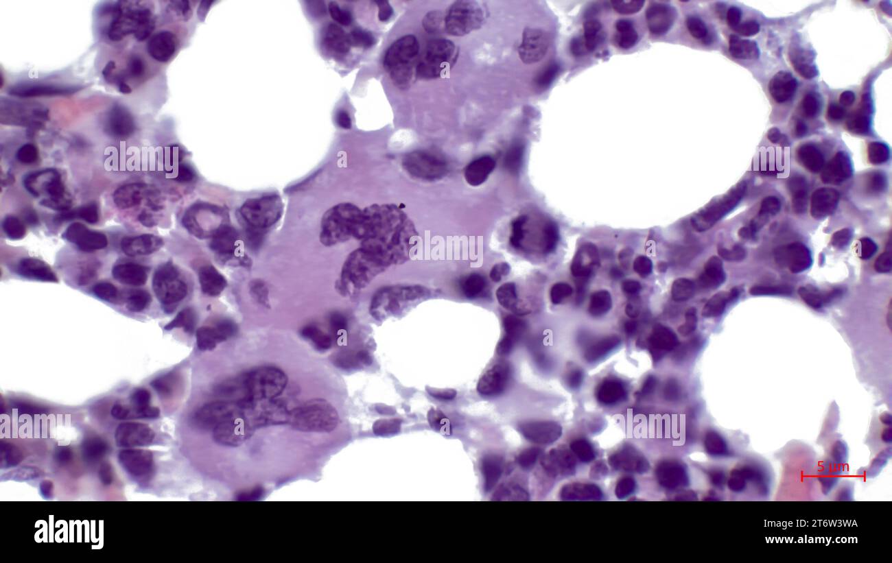 Red bone marrow, light micrograph. It consists mainly of haematopoietic ...