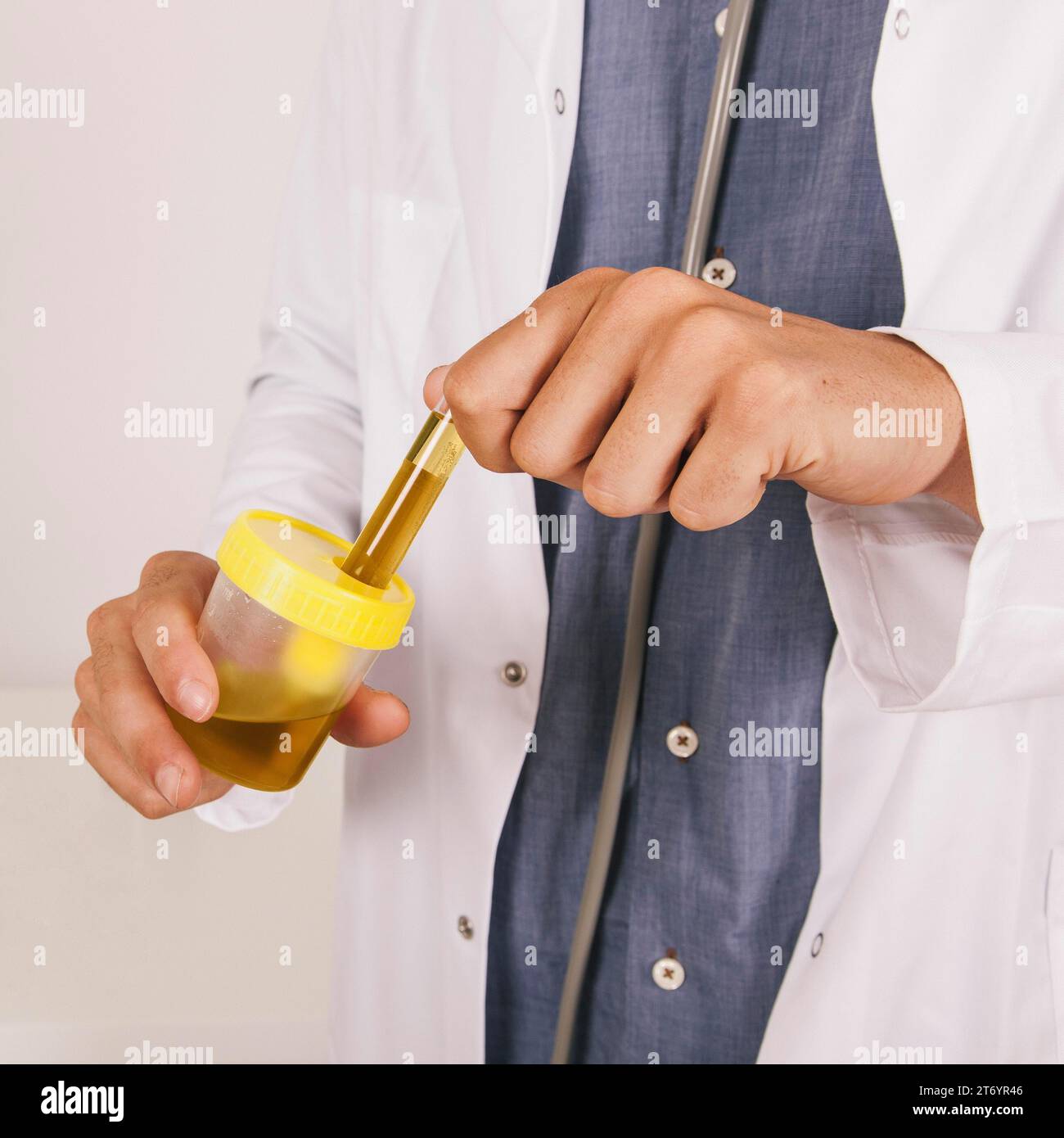 Doctor s hands holding urine test Stock Photo - Alamy