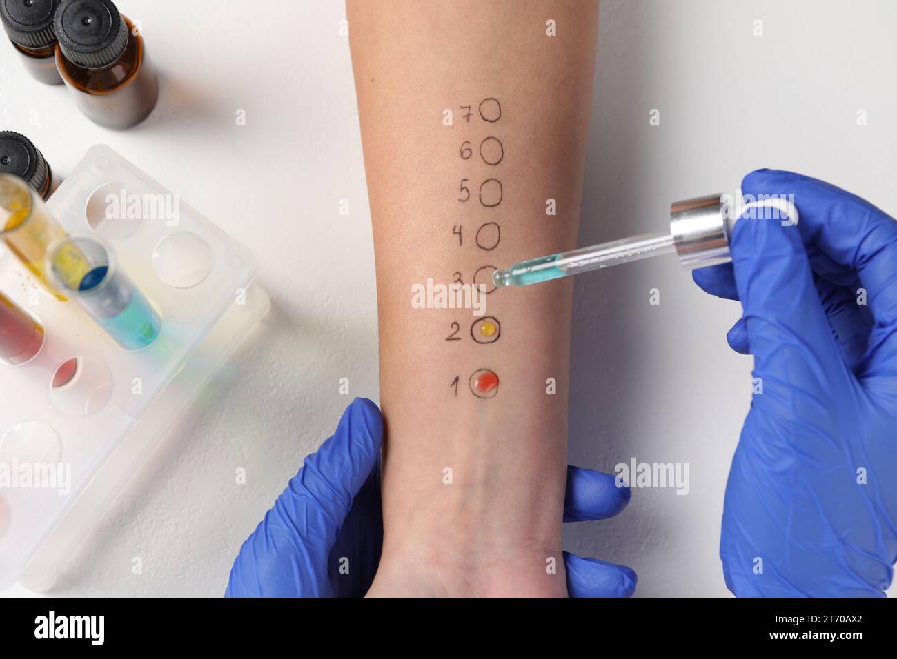 Doctor doing skin allergy test at light table, top view Stock Photo - Alamy