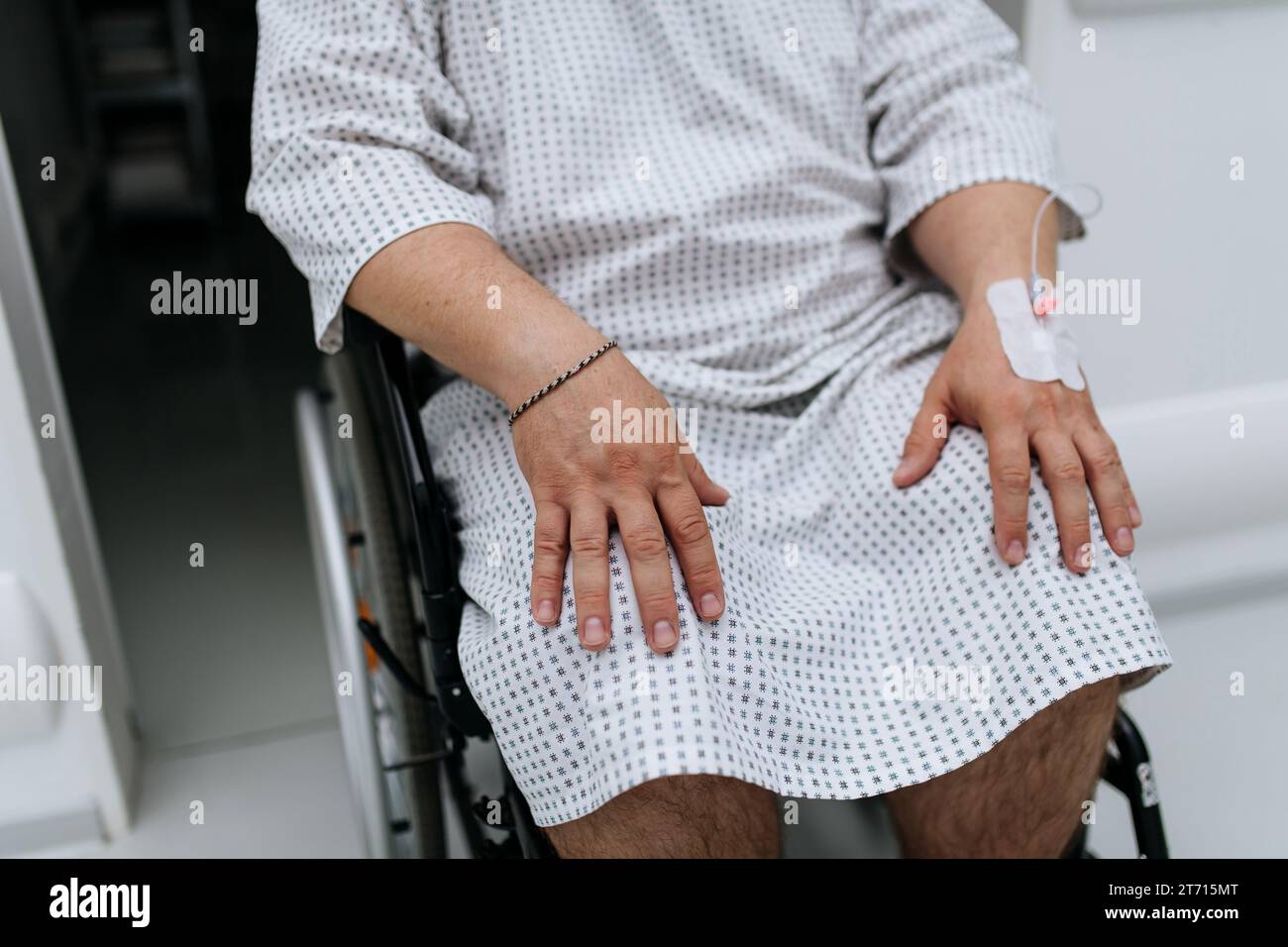 Close up of man in wheelchair with IV cannula in hand. Overweight ...