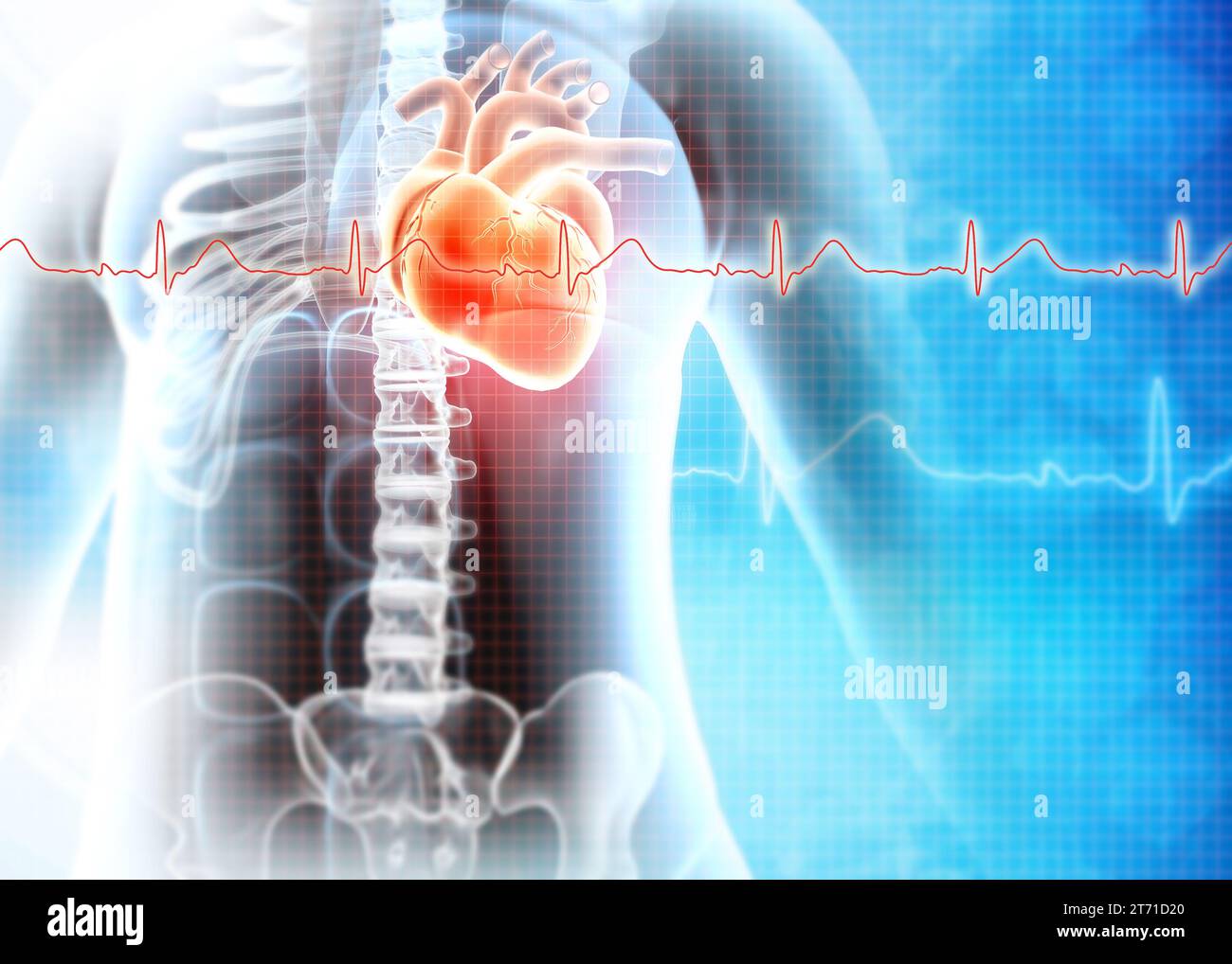 Human heart attack. Heart Disease. 3d illustration Stock Photo - Alamy