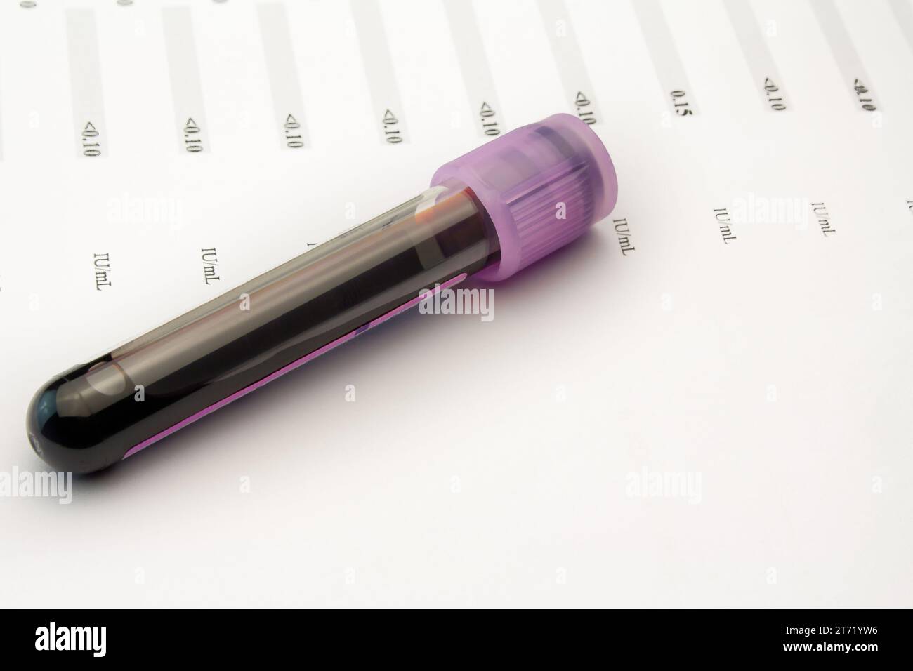 test tubes with blood on top of lab test results; test tubes with blood ...