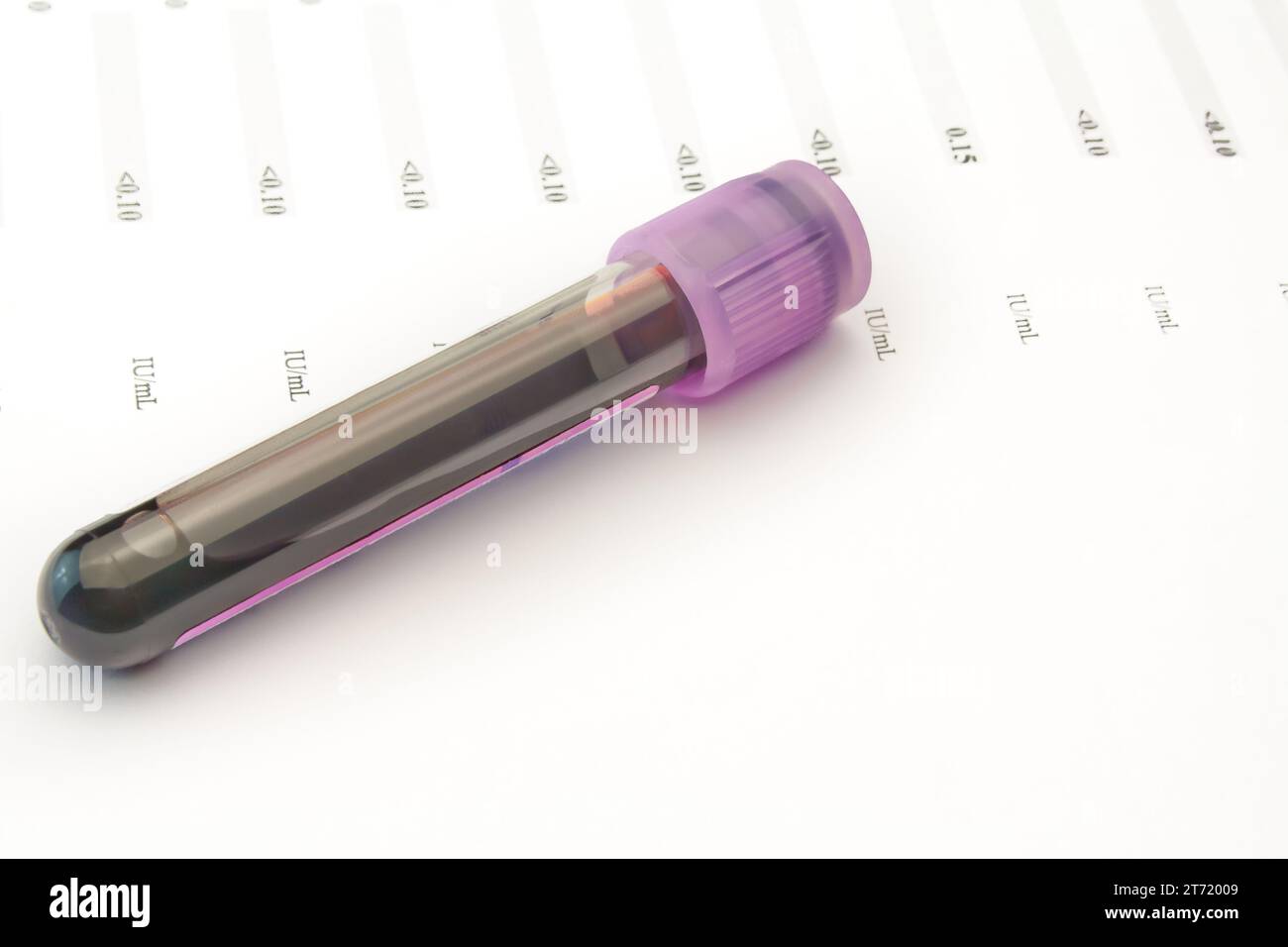 test tubes with blood on top of lab test results; test tubes with blood ...