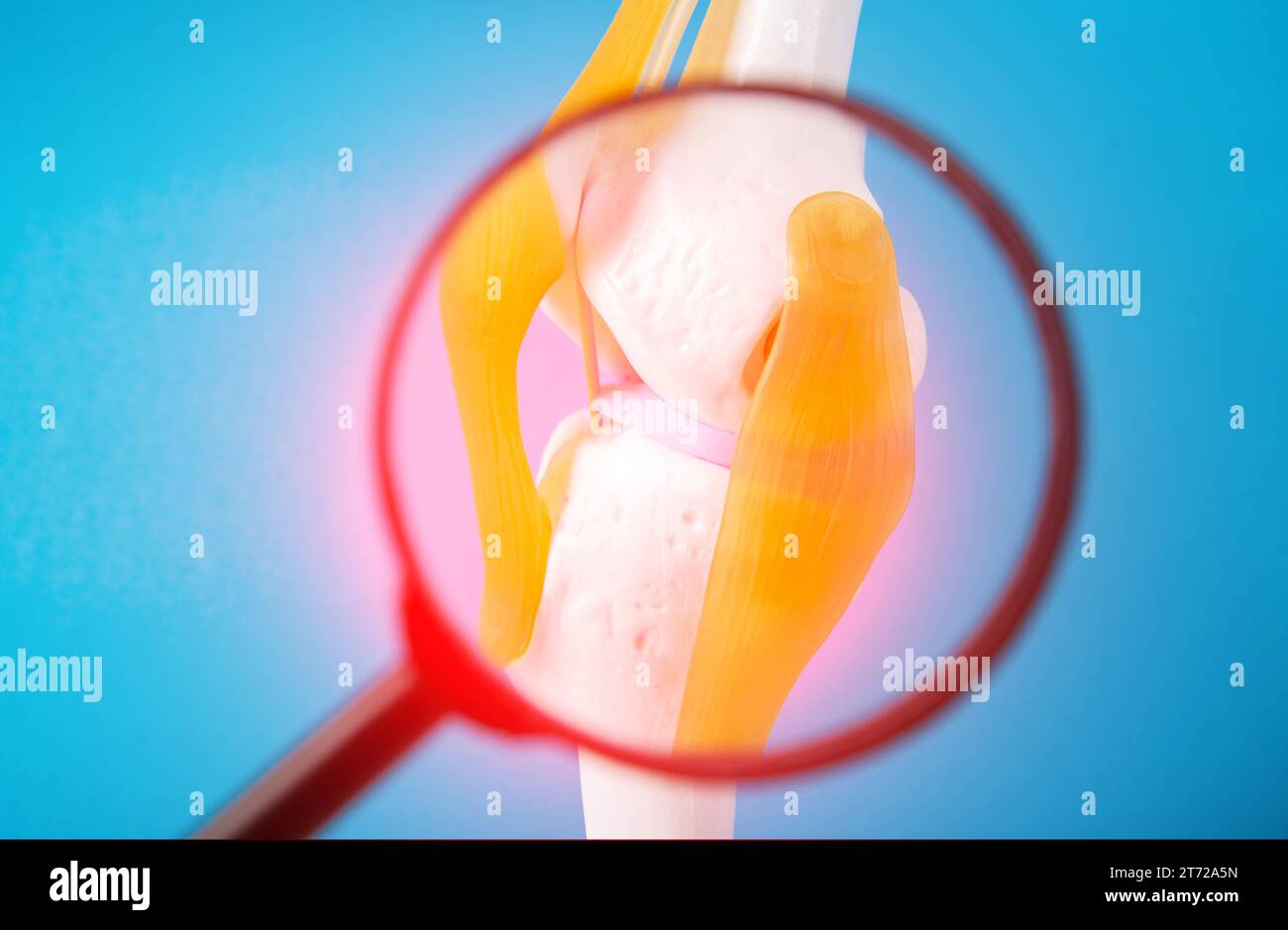 Medical mockup of a knee joint on a blue background under a magnifying ...
