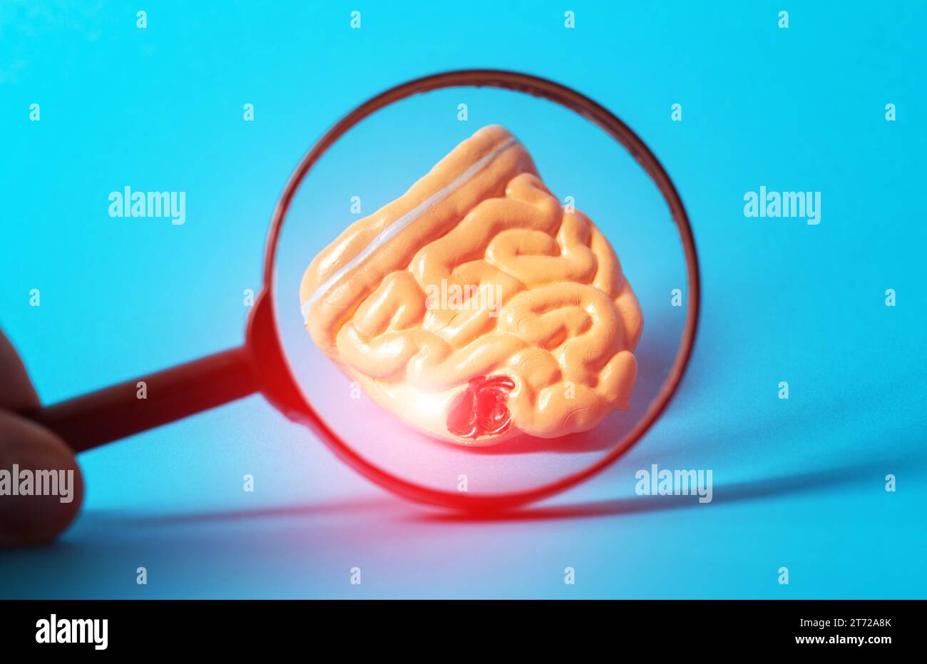Medical mockup of an inflamed human intestine under a magnifying glass ...