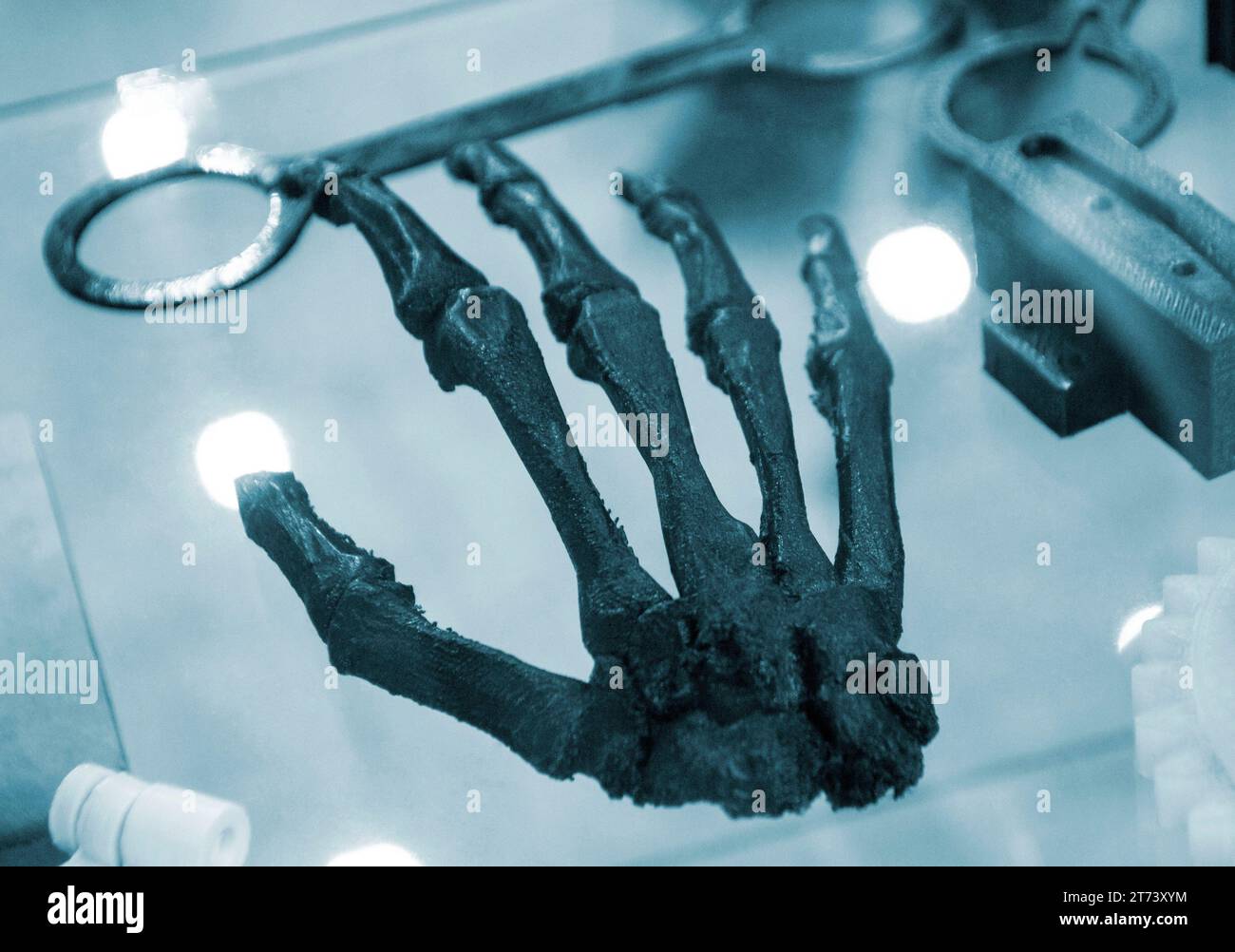 Prototype model of part of human skeleton wrist hand printed on 3D ...