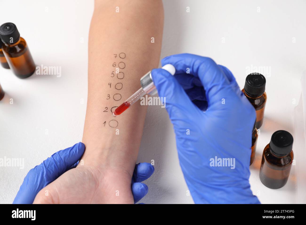 Doctor doing skin allergy test at light table, closeup Stock Photo - Alamy