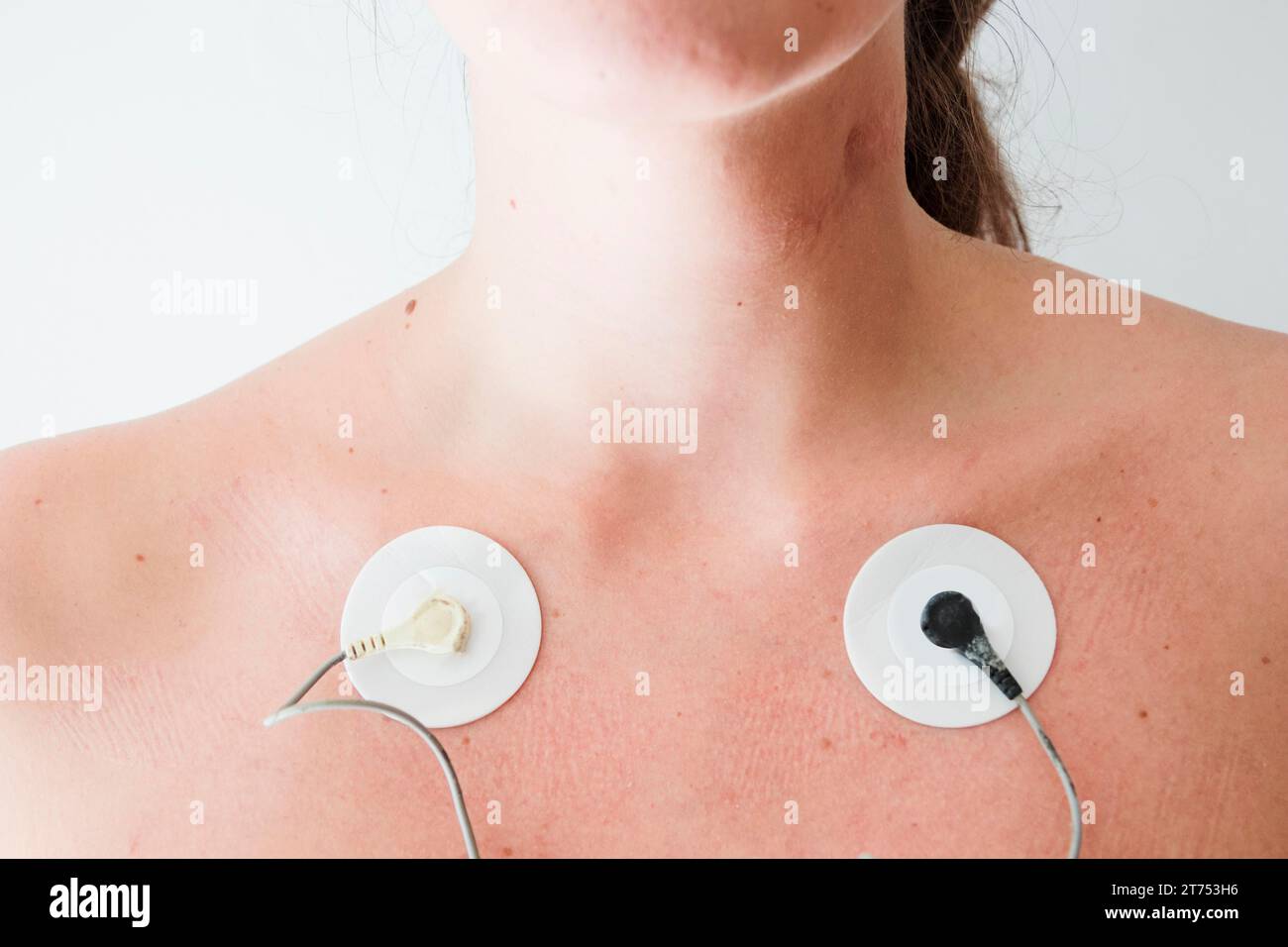 Person with electrodes body Stock Photo - Alamy
