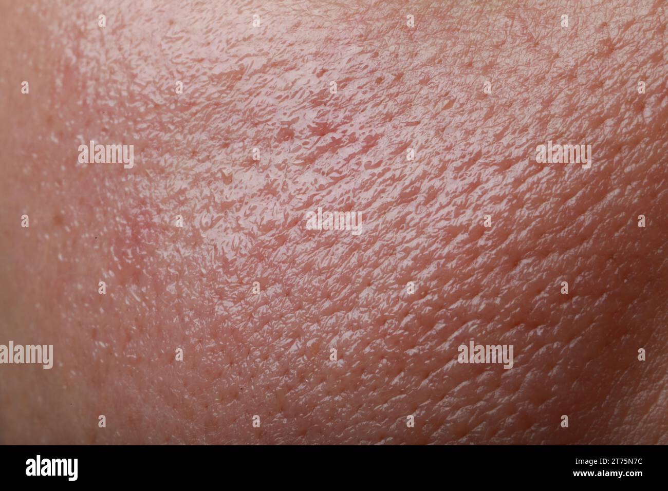 Closeup view of human oily skin as background Stock Photo - Alamy