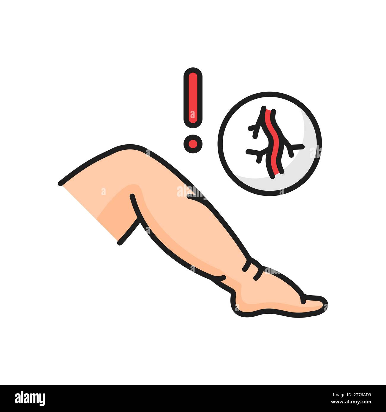 Venous disease edema color line line icon. Vector varicose vein and ...