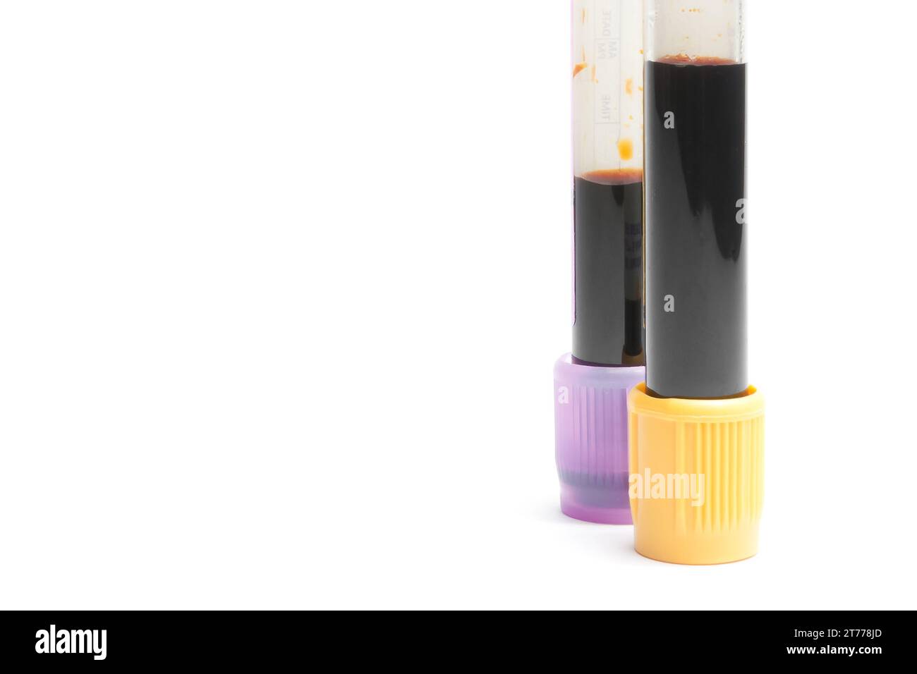 medical test tubes in laboratory with space for text on white ...