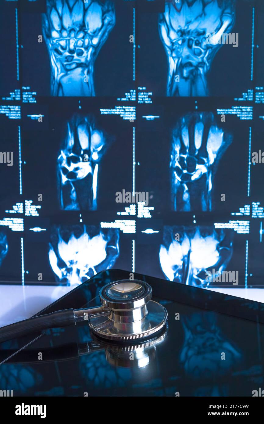 stethoscope on digital tablet pc in laboratory on x-ray images ...