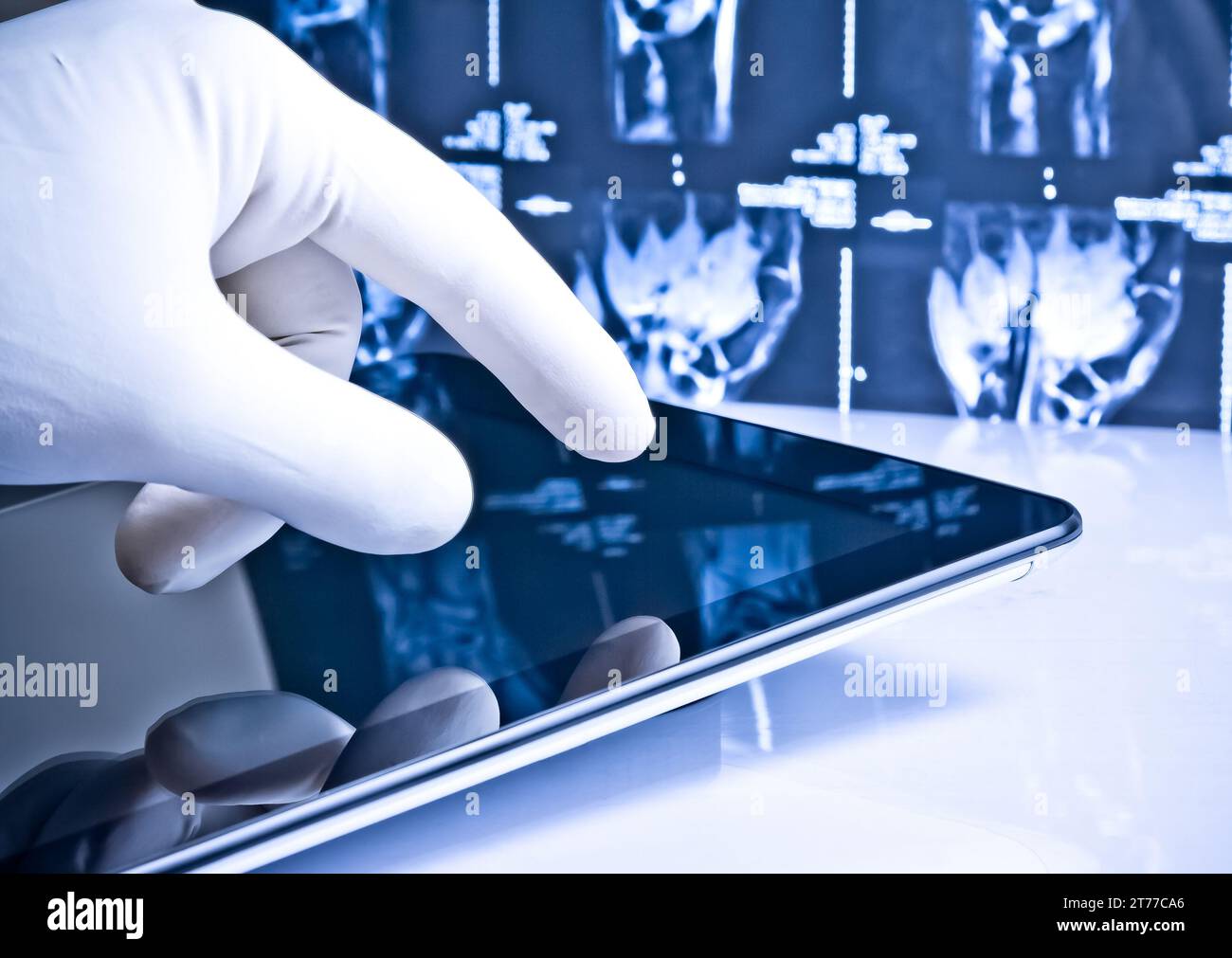 hand in medical glove touching modern digital tablet on x-ray images ...