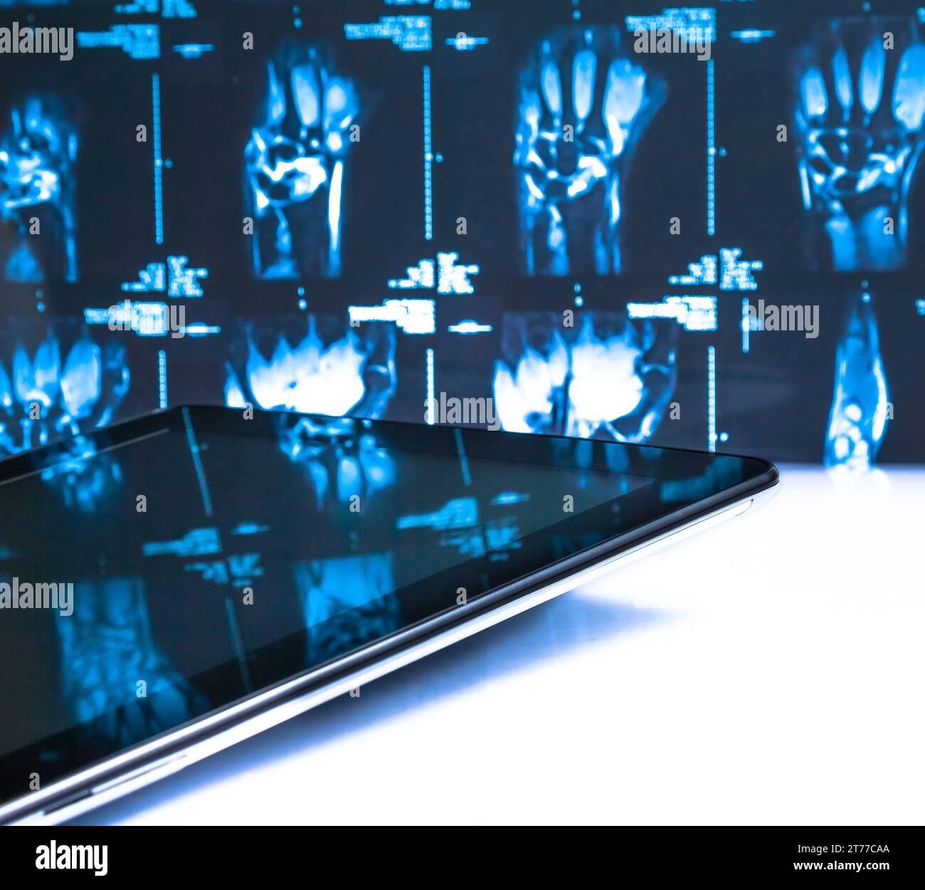 modern digital tablet pc in laboratory on x-ray images background ...
