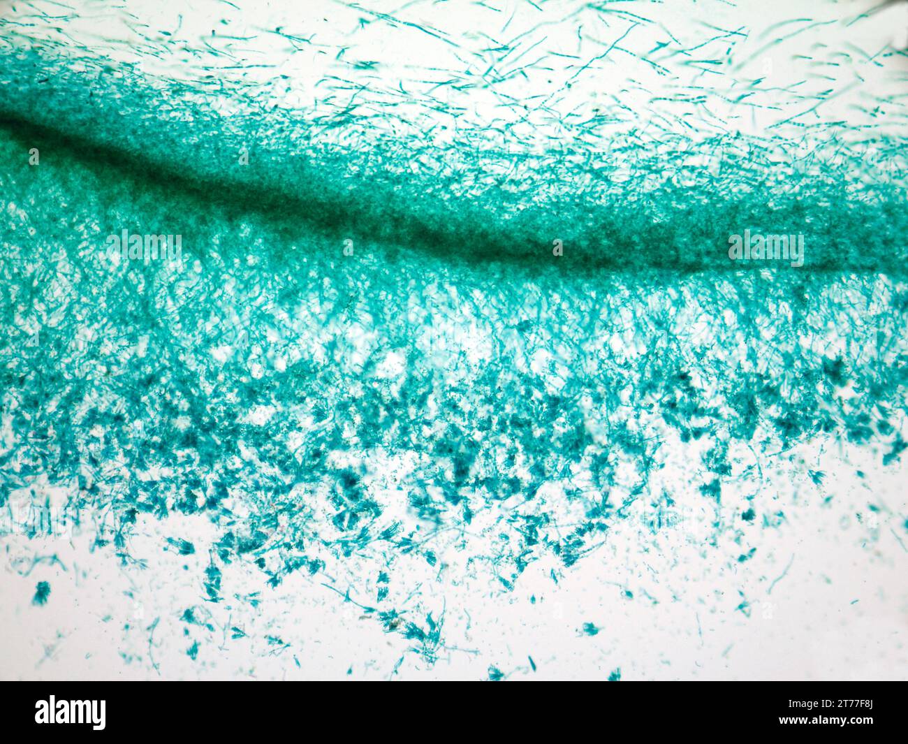 Microphotography of Penicillium. Some of Penicillium genus produce ...