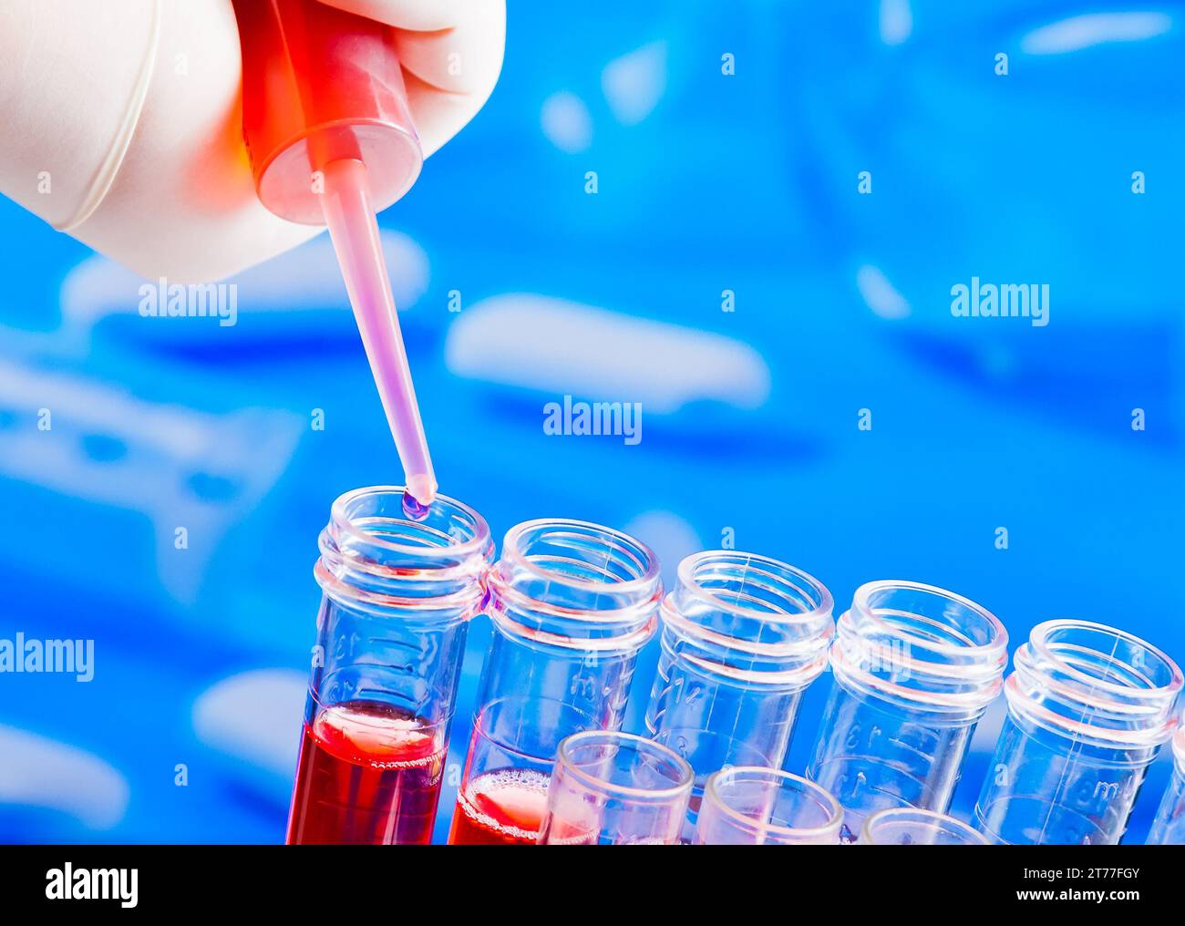 hand with pipette on test tubes with red liquid in laboratory on blue ...
