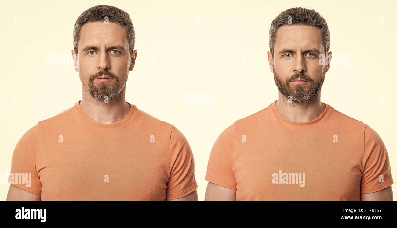 man face stubble comparison before and after isolated on white. man ...
