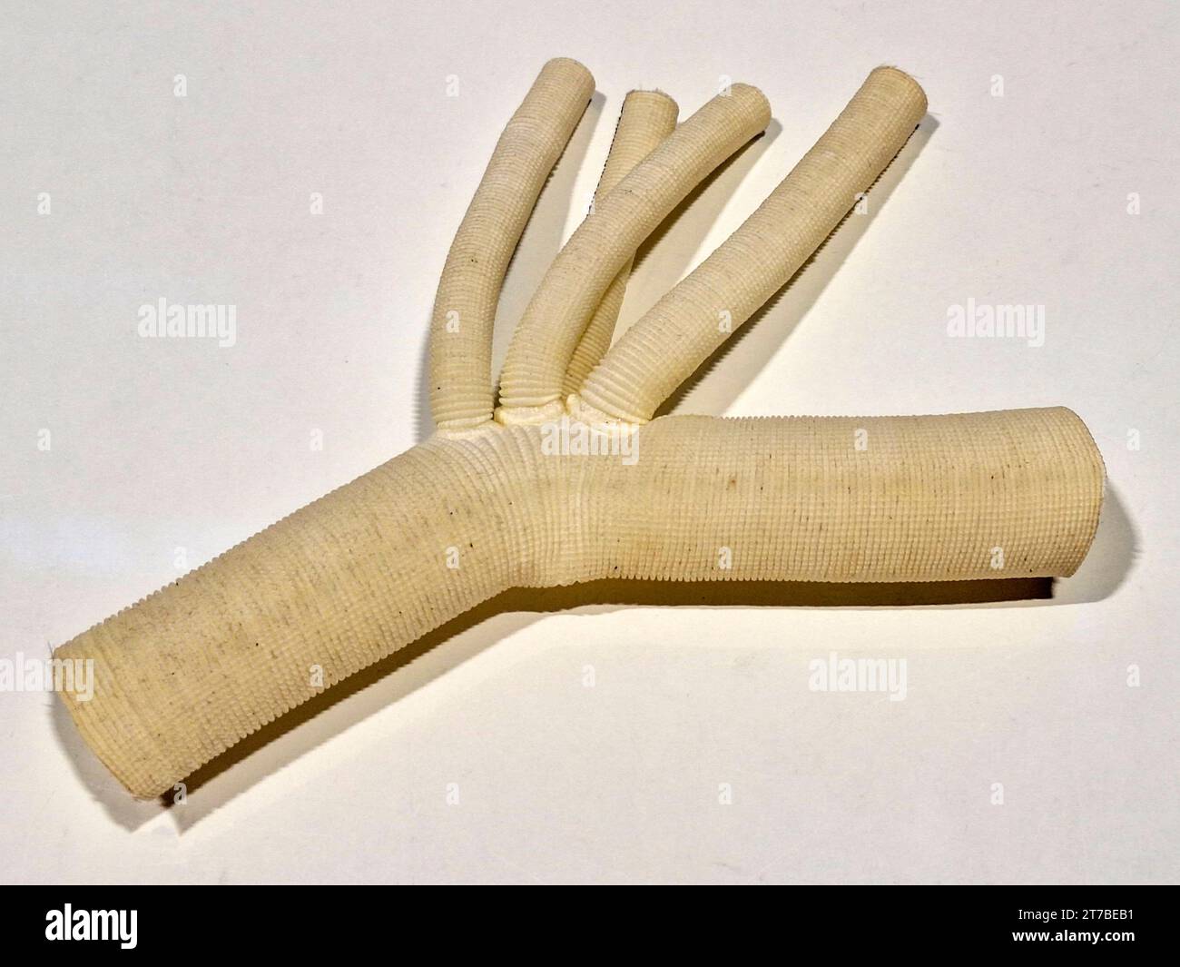 Artificial prosthesis for the aortic arch for replacement in cases such ...