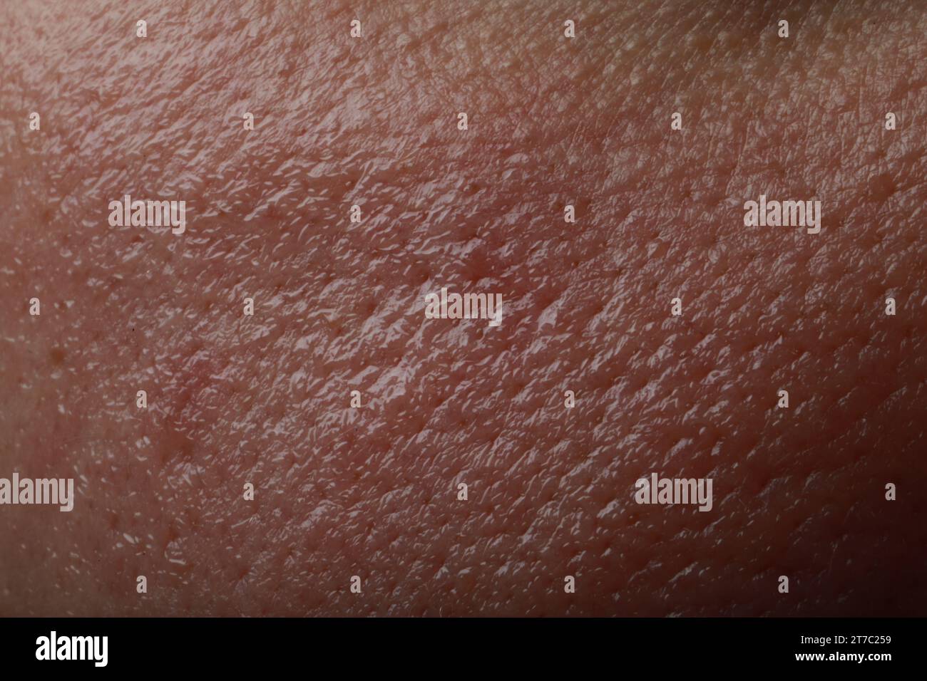 Closeup view of human oily skin as background Stock Photo - Alamy